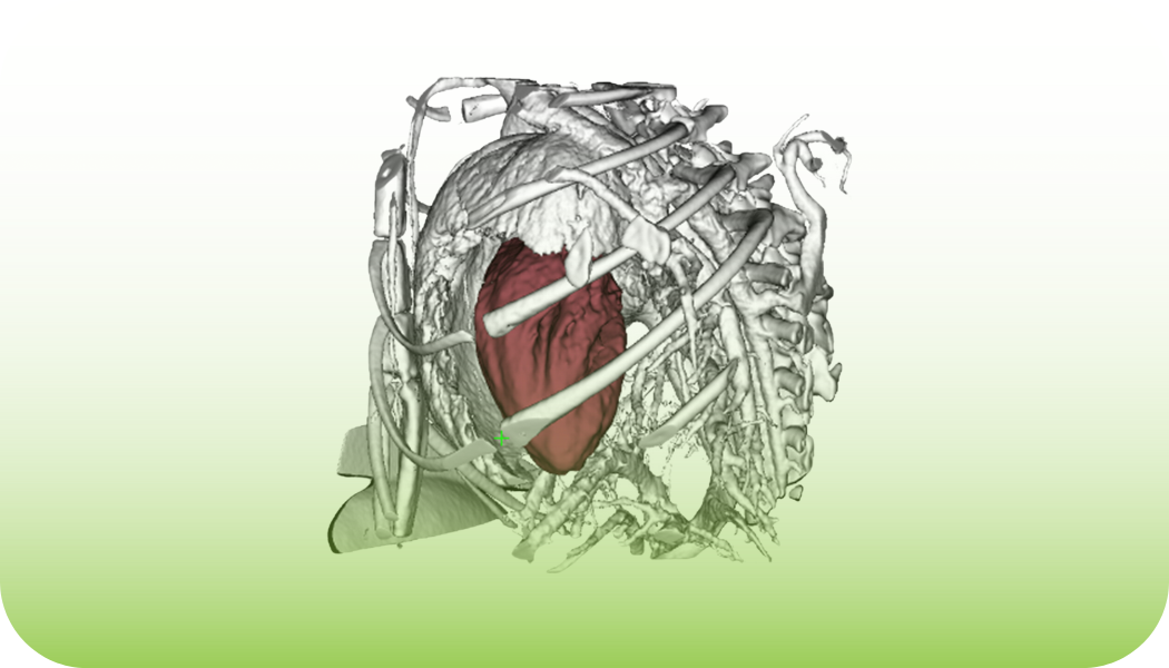 Imalytics Preclinical